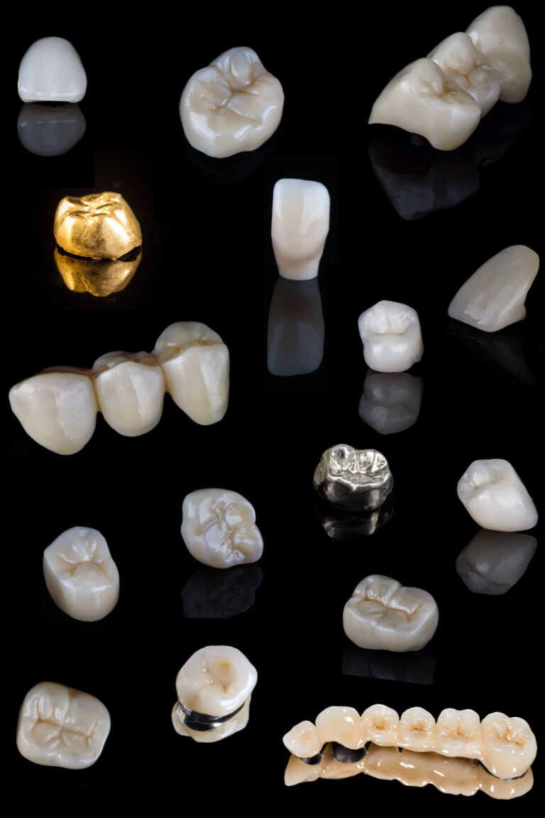 German Zahn Dental Lab – German Zahn Dental Lab